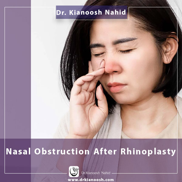 Nasal Obstruction After Rhinoplasty : Causes And Management