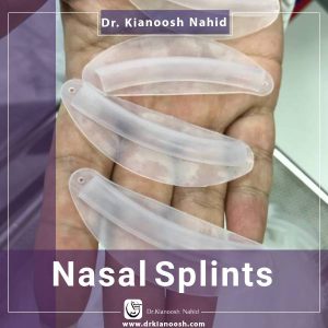 Internal Nasal Splints + Indications, Benefits and Downside