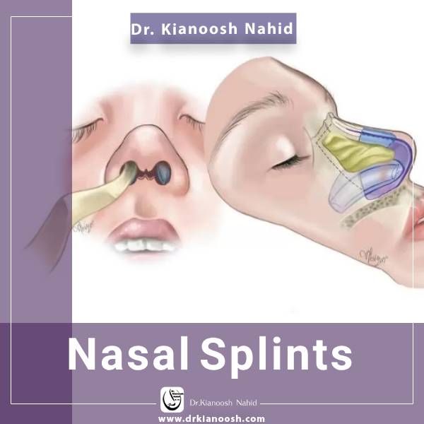 Internal Nasal Splints + Indications, Benefits and Downside